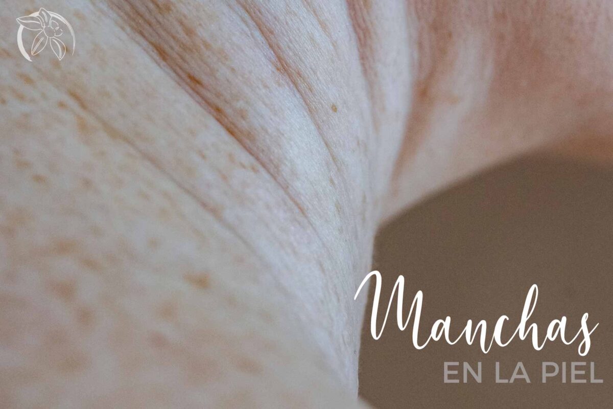 ¿Cómo eliminar manchas en la piel con remedios caseros?